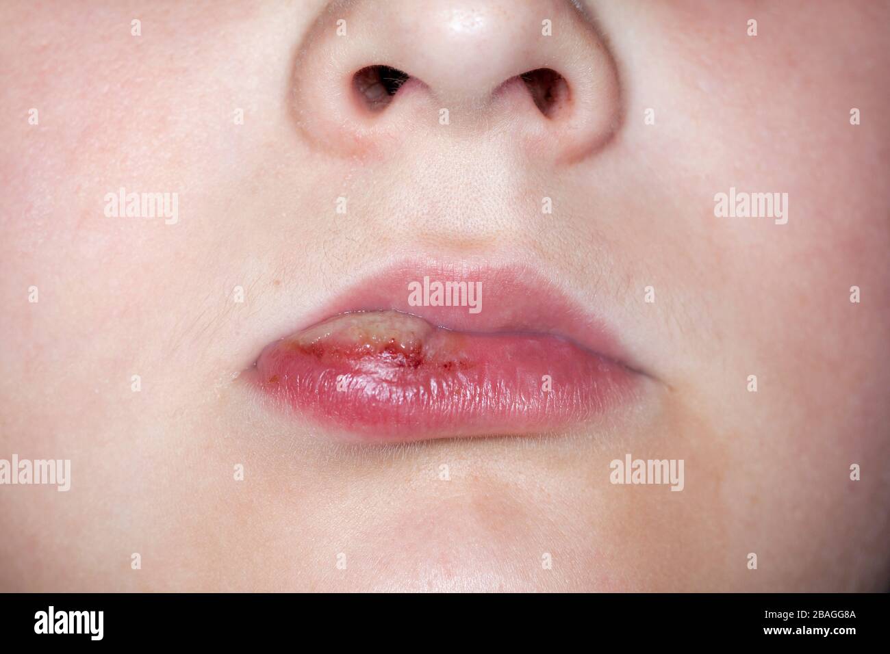 Woman big lips close up hi-res stock photography and images - Alamy