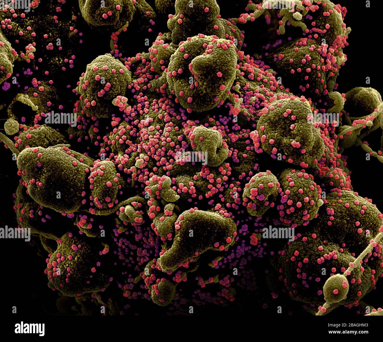 Transmission electron microscope color enhanced hi-res stock ...