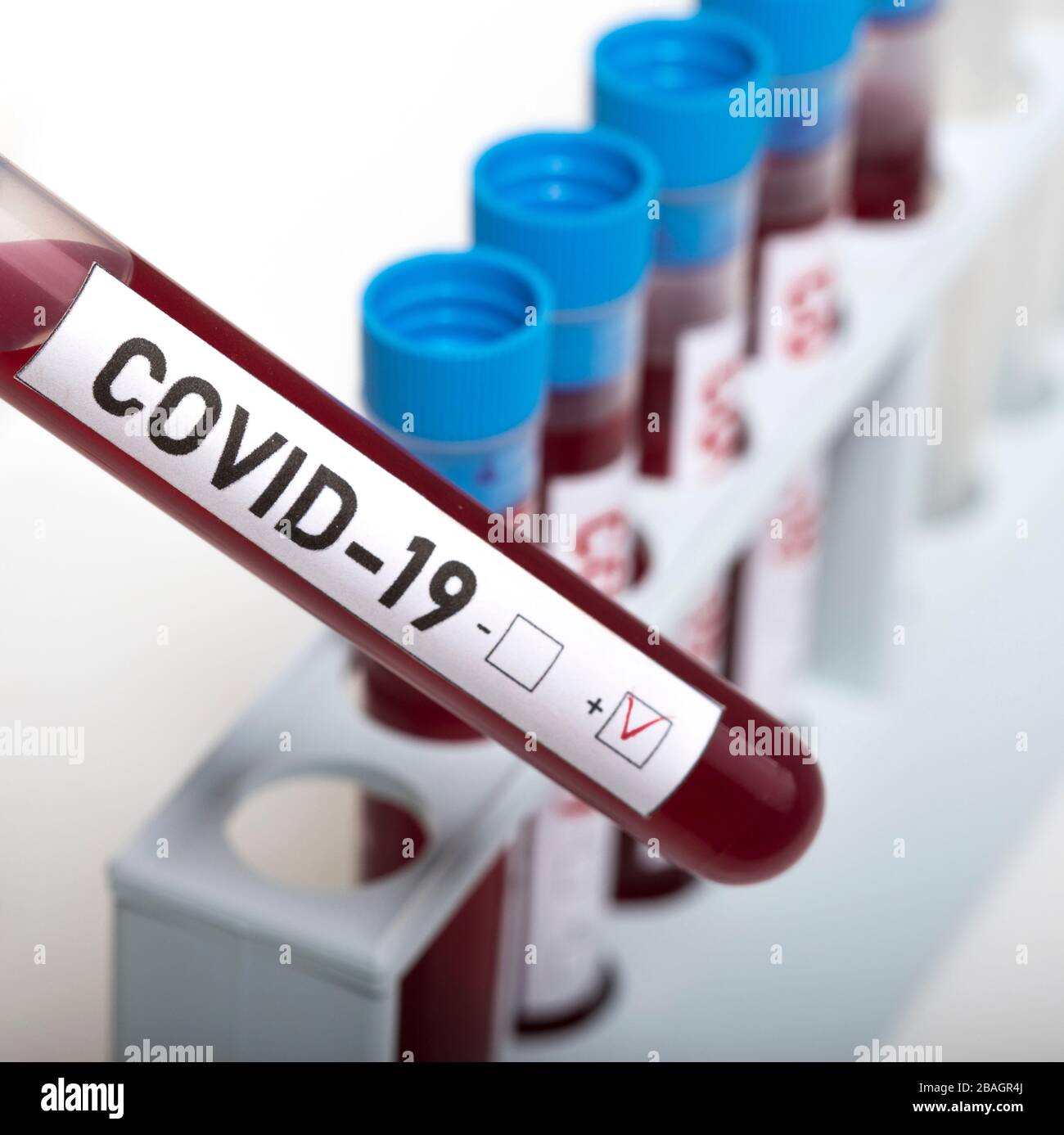 Tubes of biological sample contaminated by Coronavirus with label Covid ...