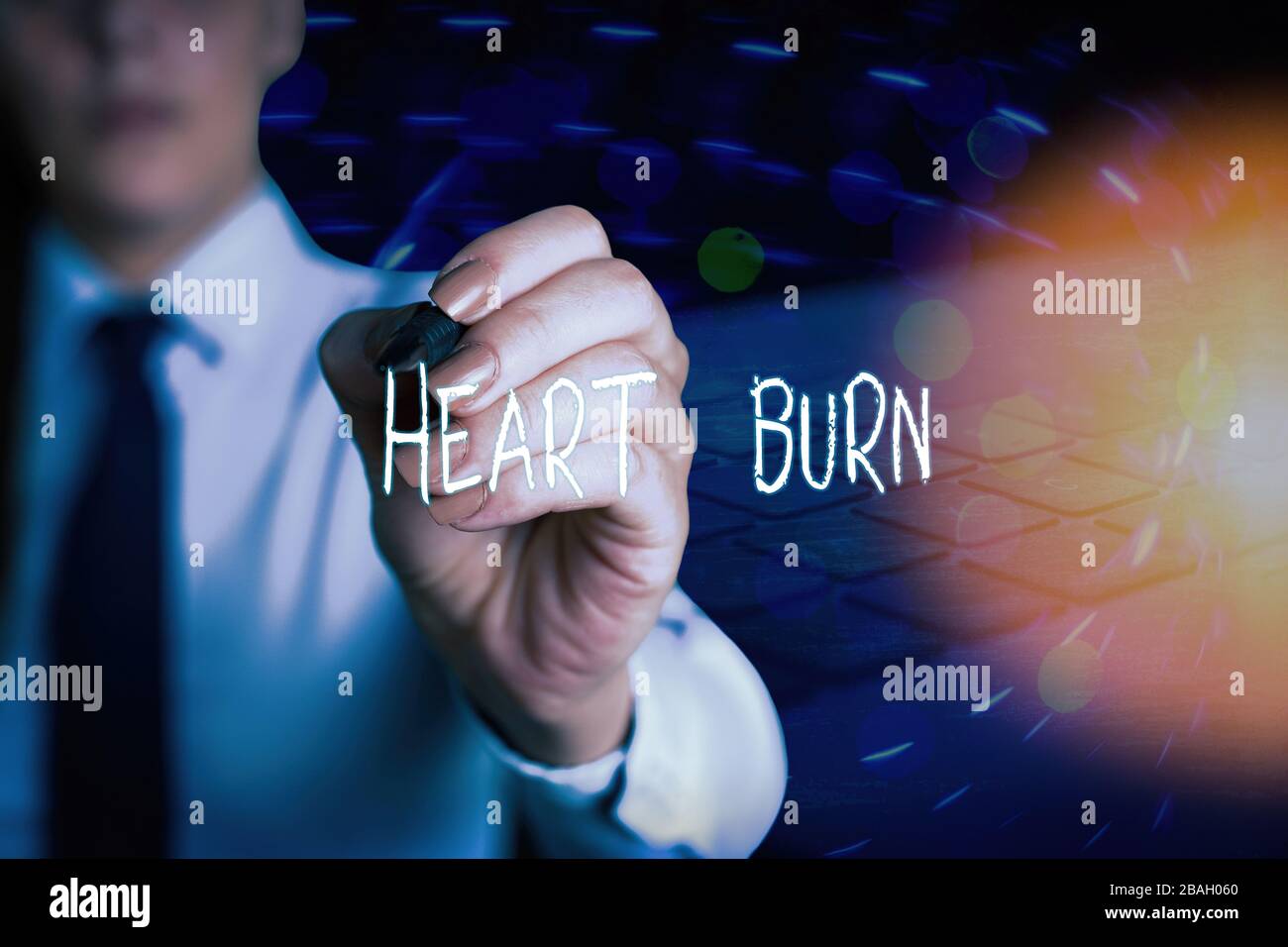Writing note showing Heart Burn. Business concept for a burning ...