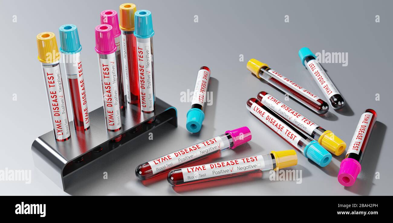 Lyme disease virus - test tubes, blood tests - 3D illustration Stock ...