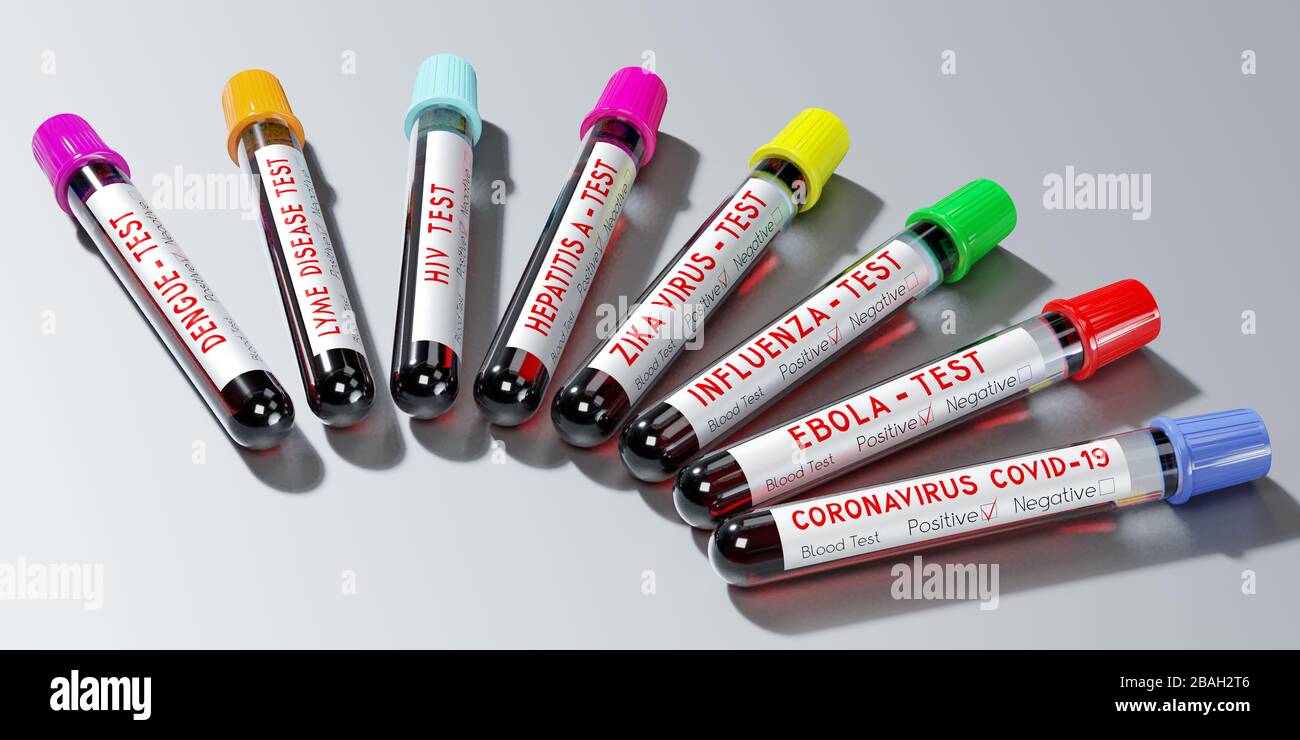 Various virus test tubes - 3D illustration Stock Photo - Alamy