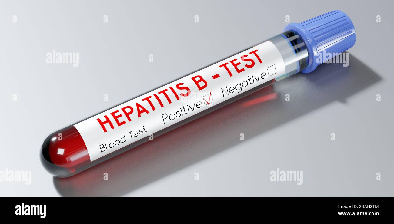 Hepatitis B virus - test tube, blood test - 3D illustration Stock Photo ...