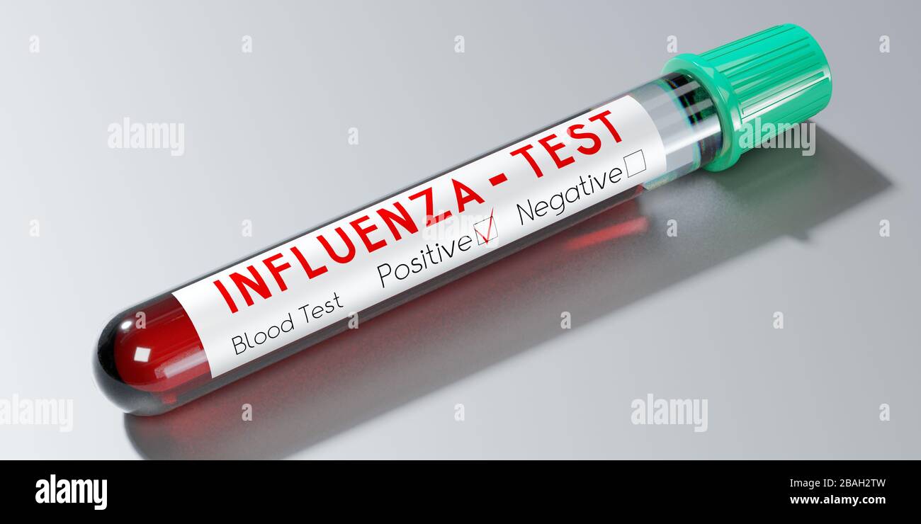 Influenza virus - test tube, blood test - 3D illustration Stock Photo ...