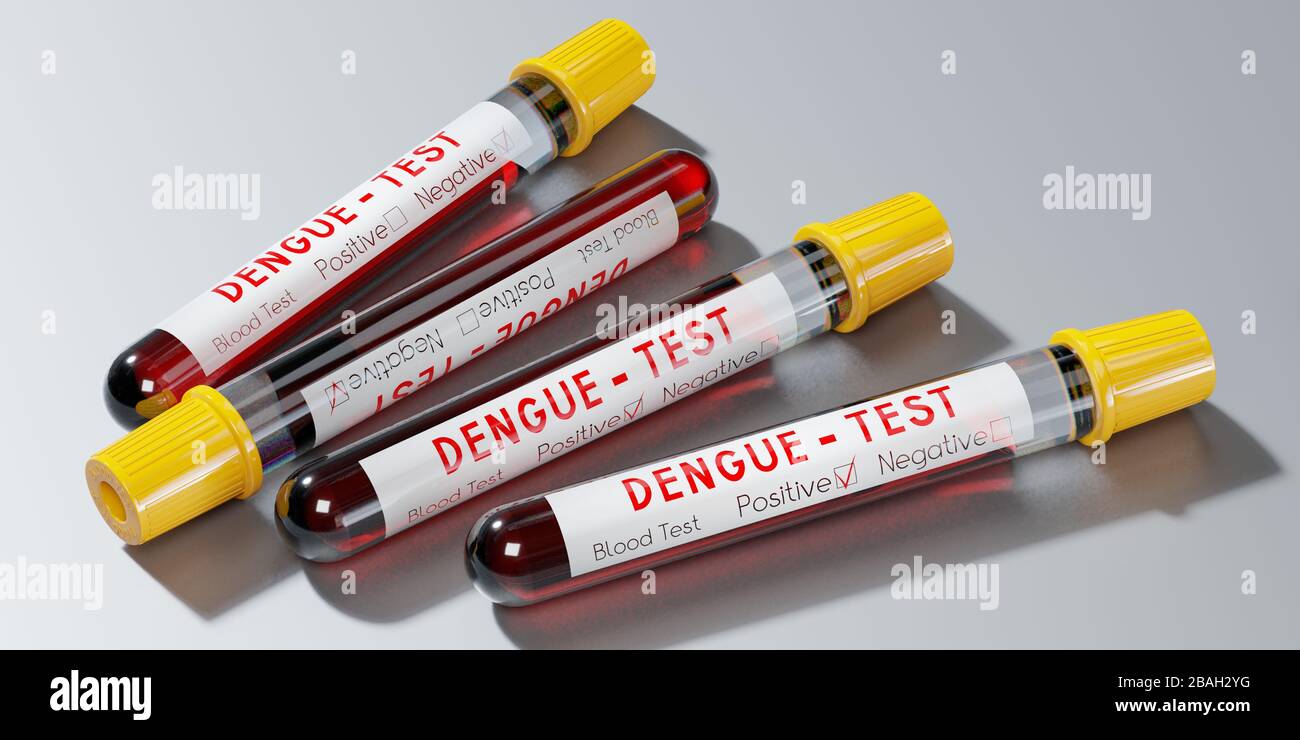 Dengue test hi-res stock photography and images - Alamy