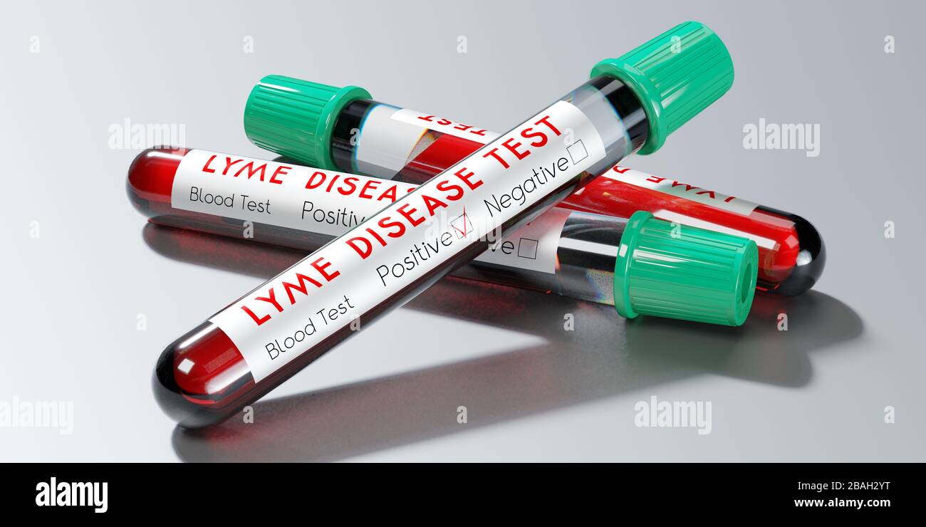 Lyme disease virus - test tubes, blood tests - 3D illustration Stock ...