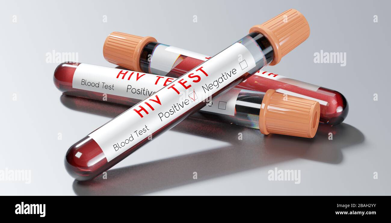 Hiv negative hi-res stock photography and images - Alamy
