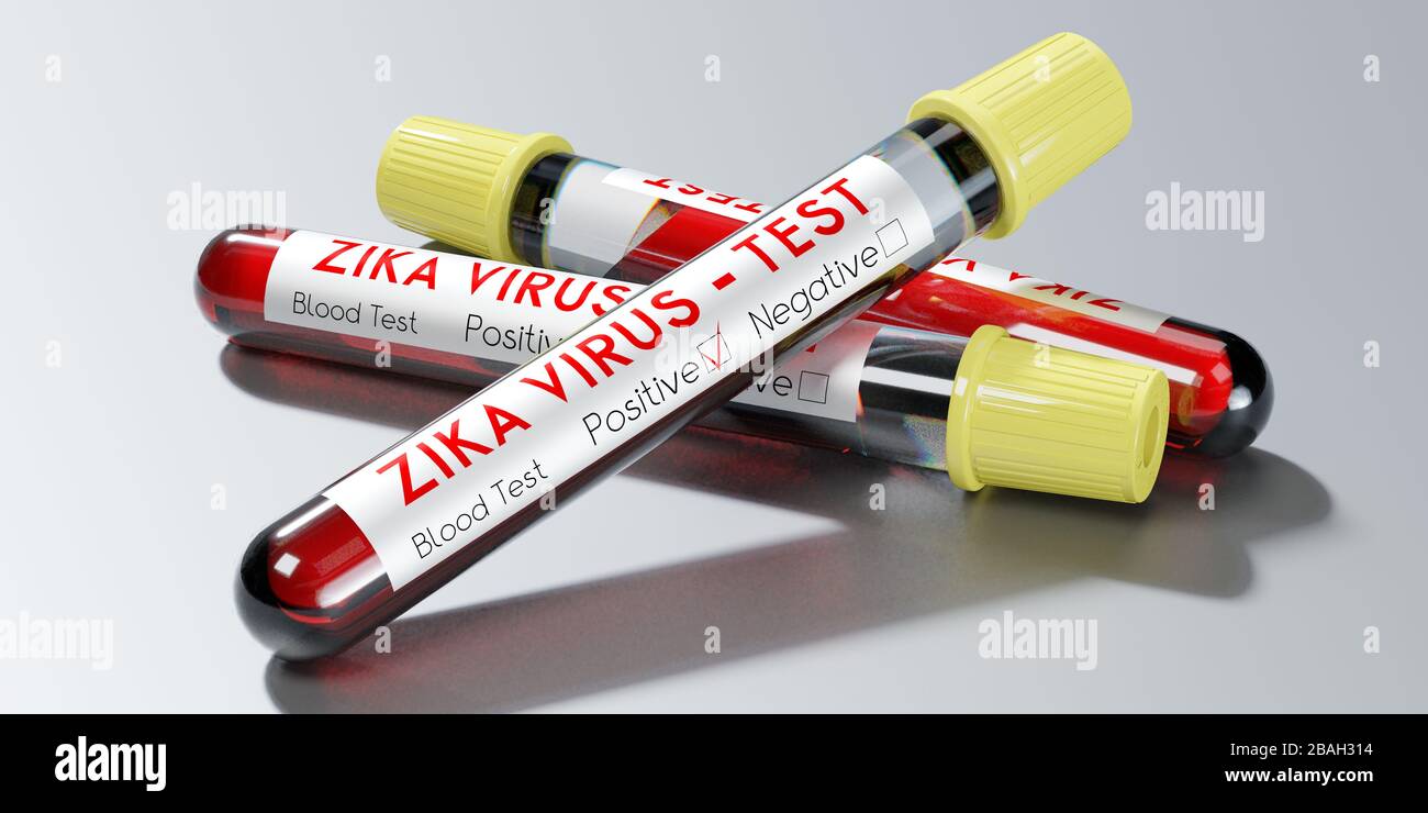 ZIKA virus - test tubes, blood tests - 3D illustration Stock Photo - Alamy
