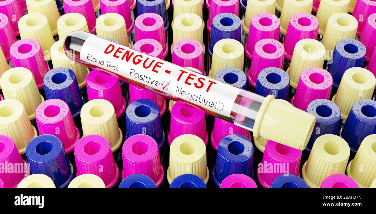 Dengue virus - test tubes, blood tests - 3D illustration Stock Photo ...