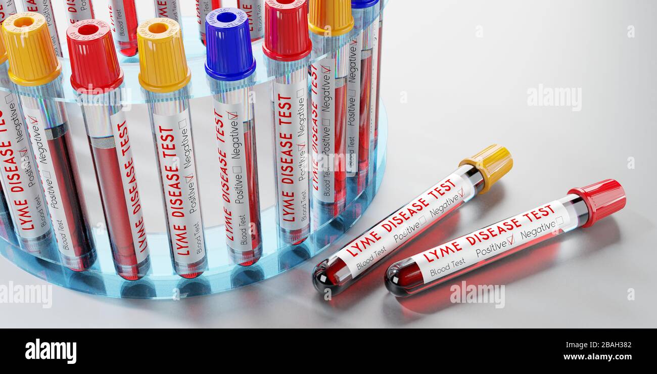 Lyme disease virus - test tubes, blood tests - 3D illustration Stock ...