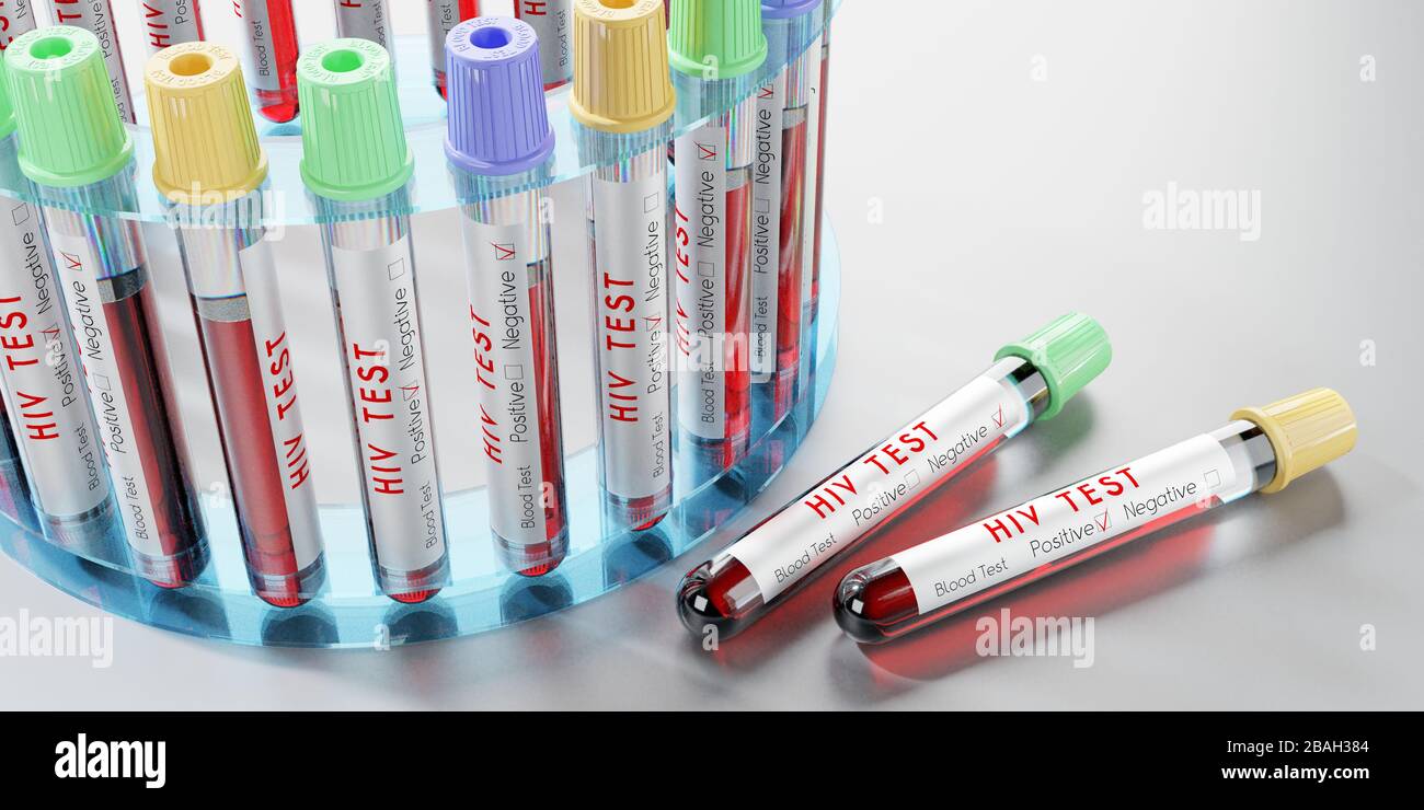 Hiv virus hi-res stock photography and images - Alamy