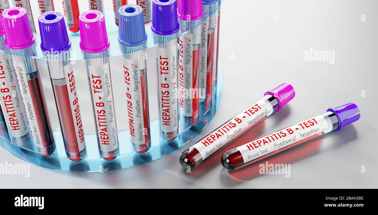 Hepatitis B virus - test tubes, blood tests - 3D illustration Stock ...