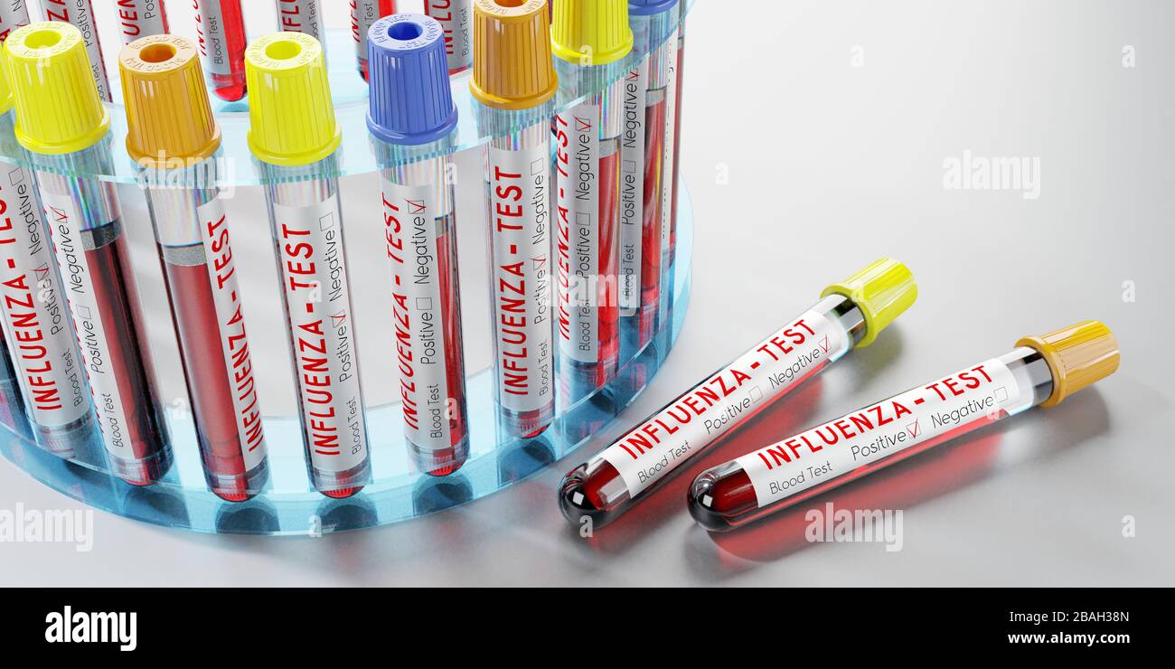 Influenza virus - test tubes, blood tests - 3D illustration Stock Photo ...