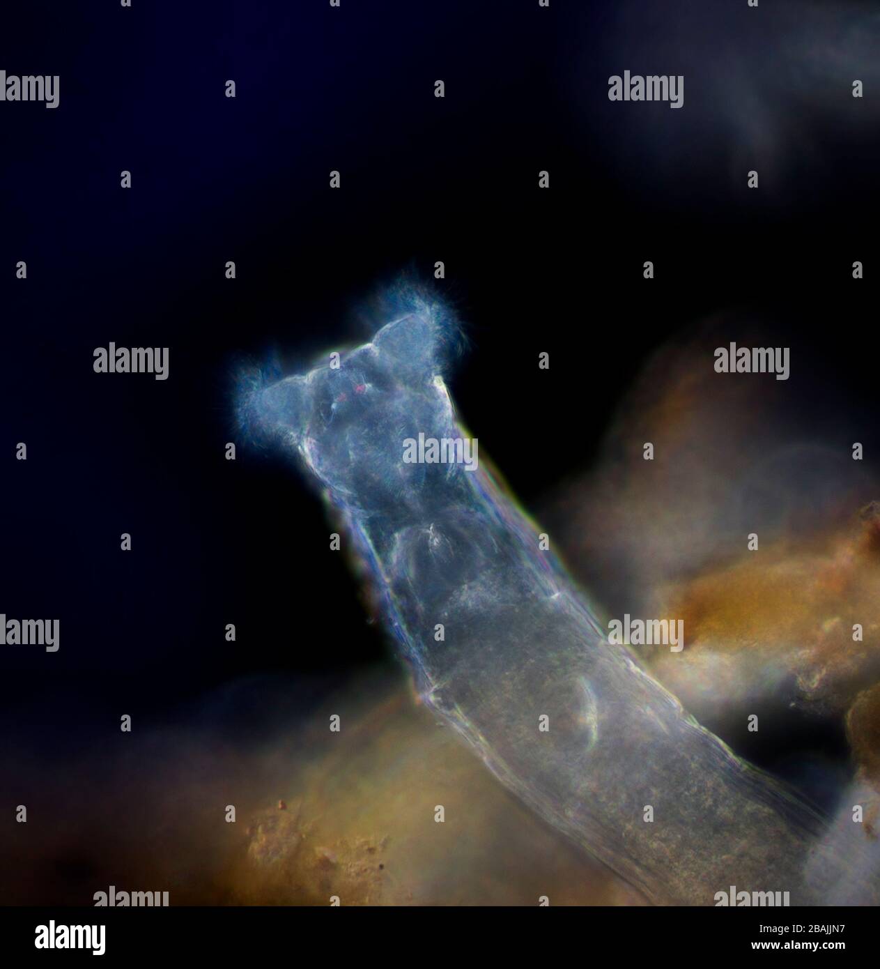 Rotifer or rotifers or stephanoceros hi-res stock photography and ...