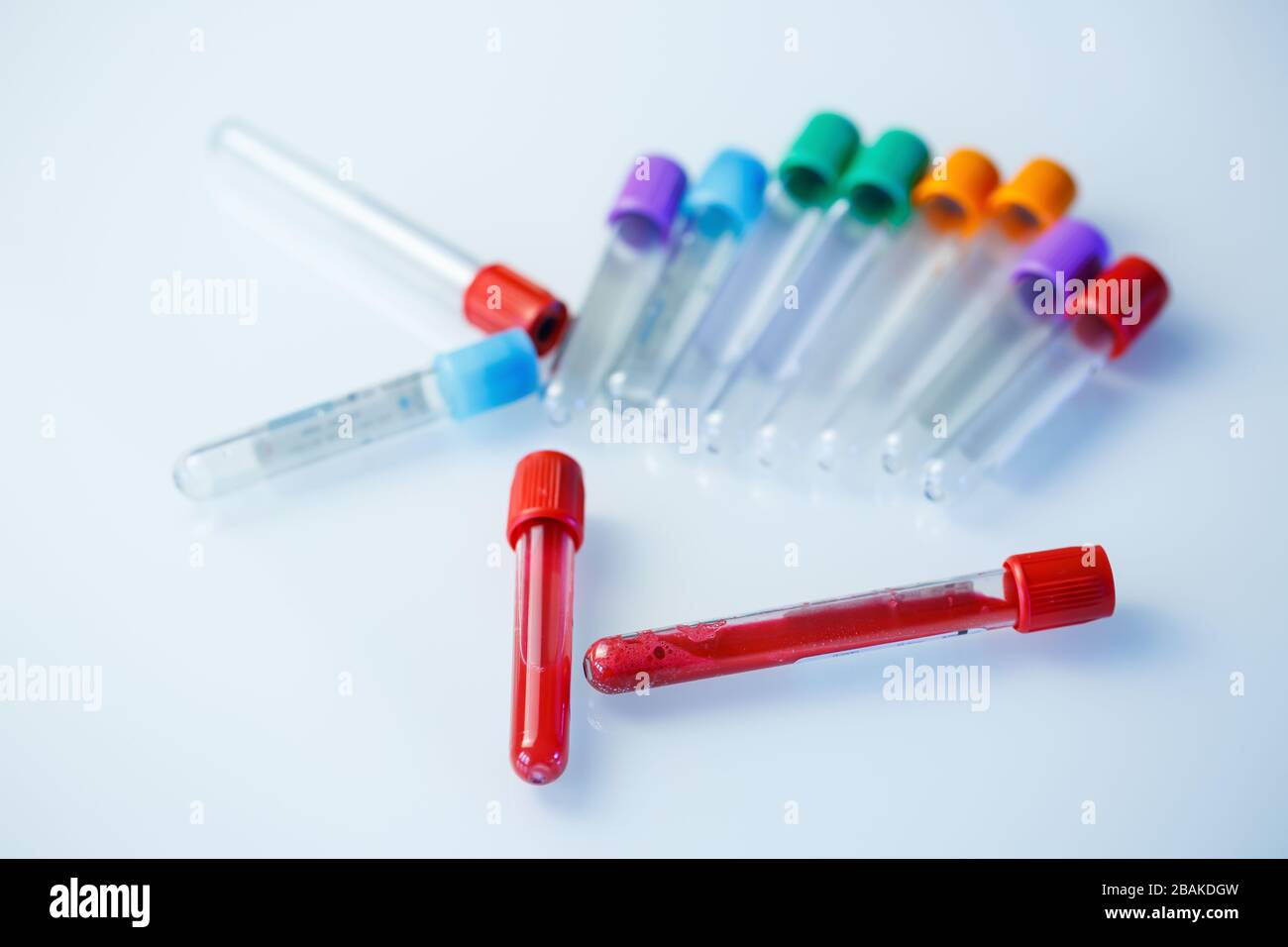 Test tubes for blood analysis. Check for the virus. Medical Devices ...