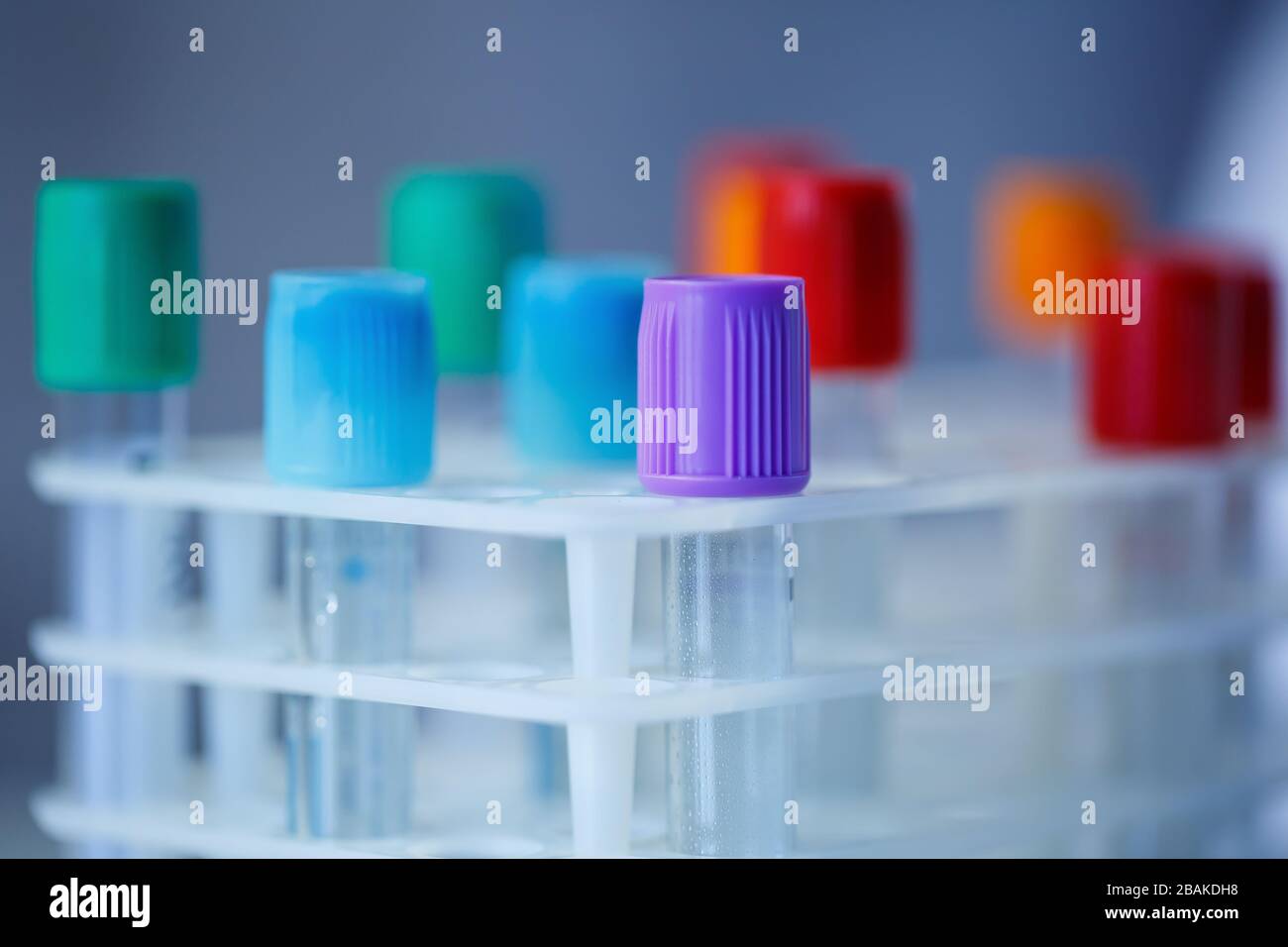 Test tubes for blood analysis. Check for the virus. Medical Devices ...