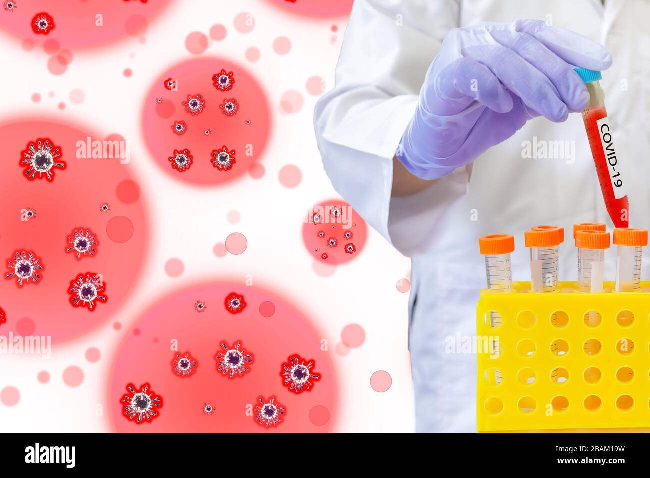 Microbiologist with a tube of biological sample contaminated by ...