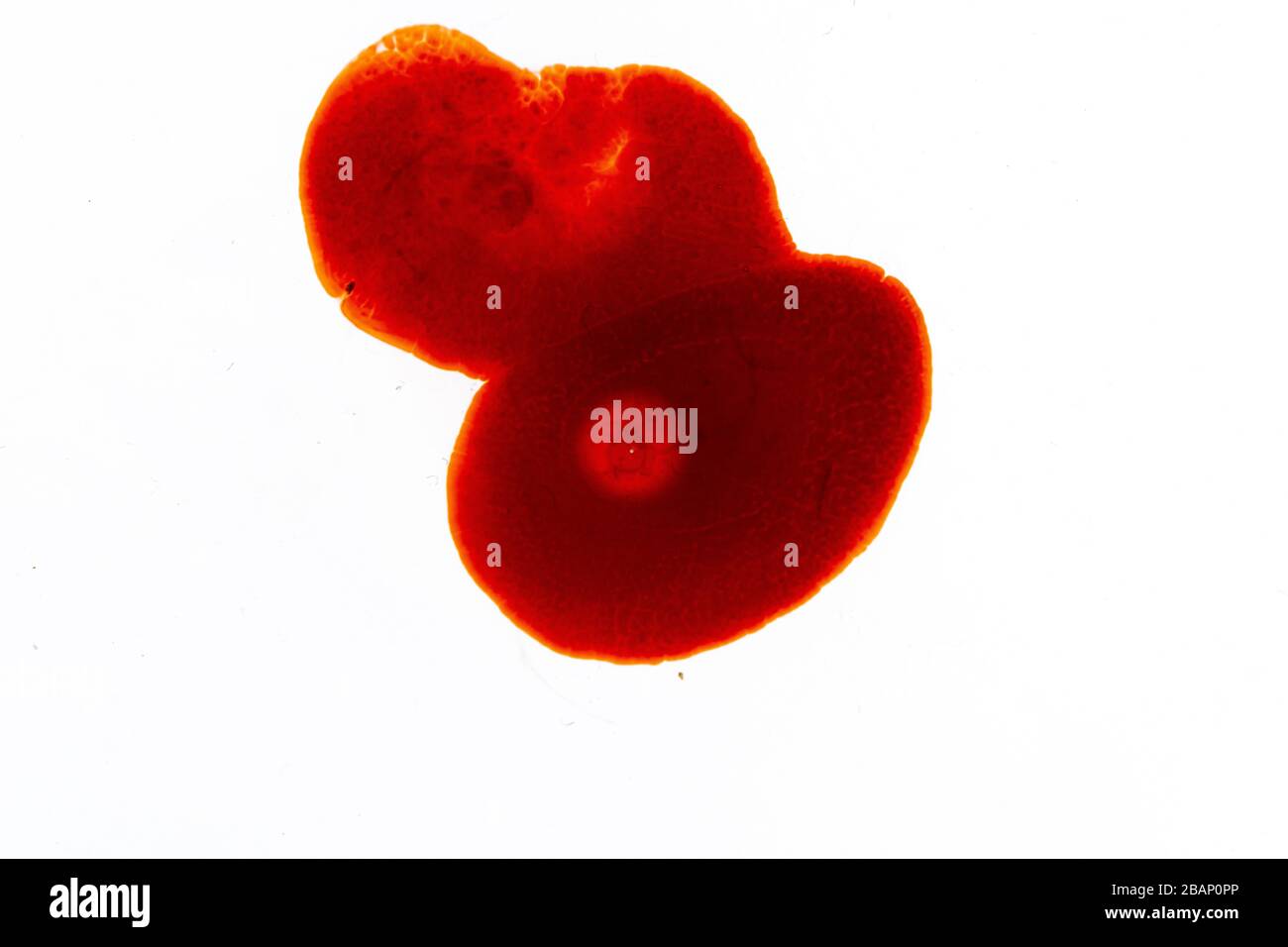 Image of blood-colored liquids mixed with other organic fluids ...