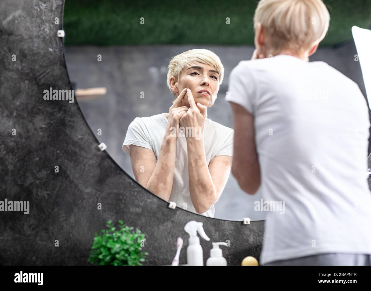 Lady With Acne Problem Squeezing Pimple In Bathroom At Home Stock Photo ...