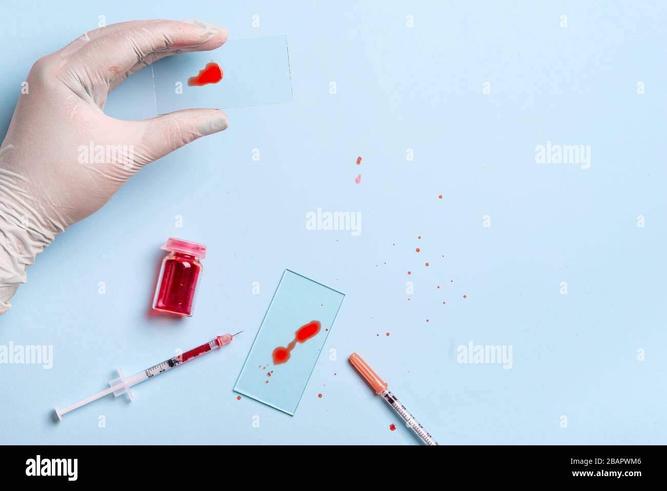 Blood sample on glass slide hi-res stock photography and images - Alamy