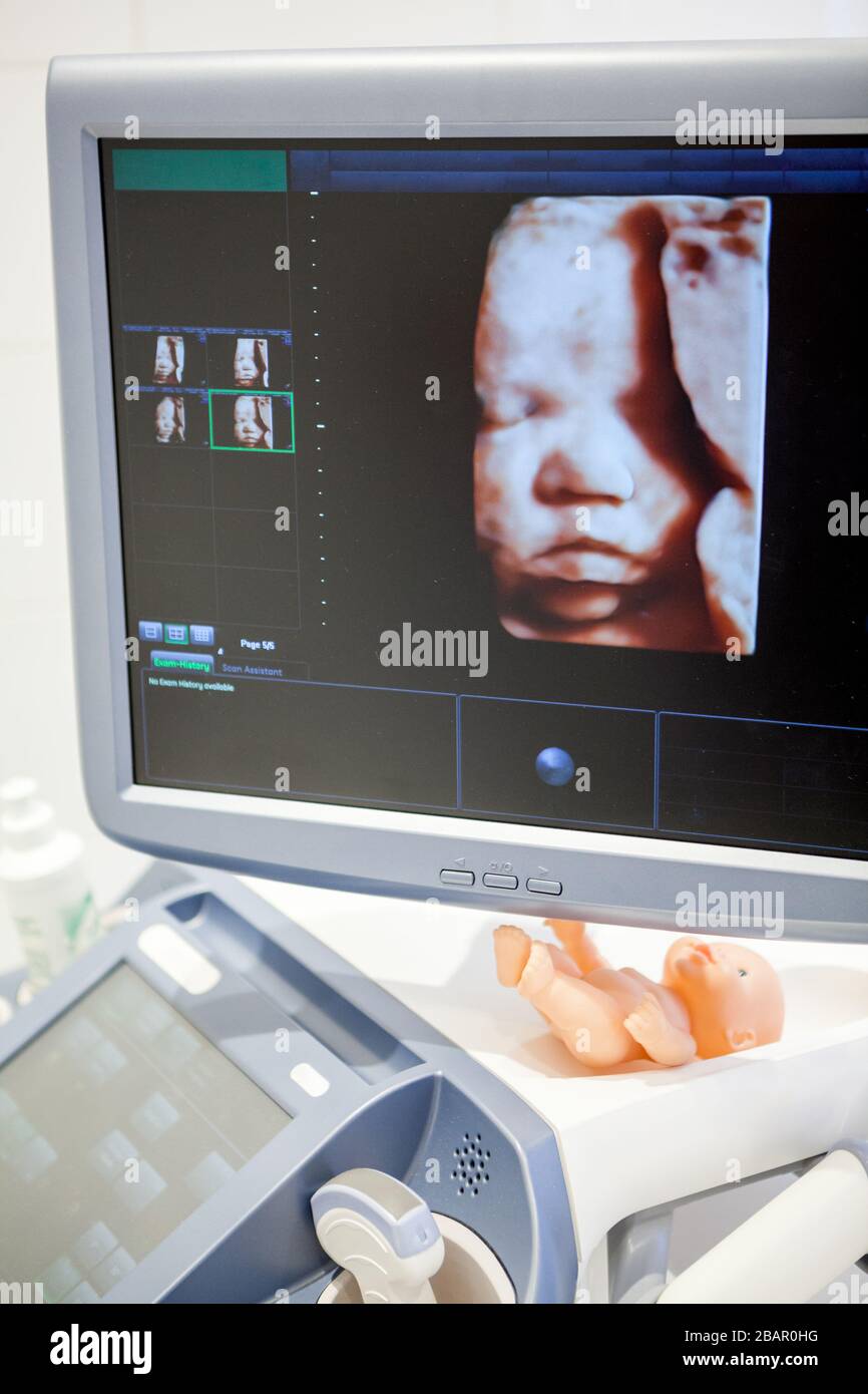 Ultrasound cardiology monitor screen close hi-res stock photography and ...