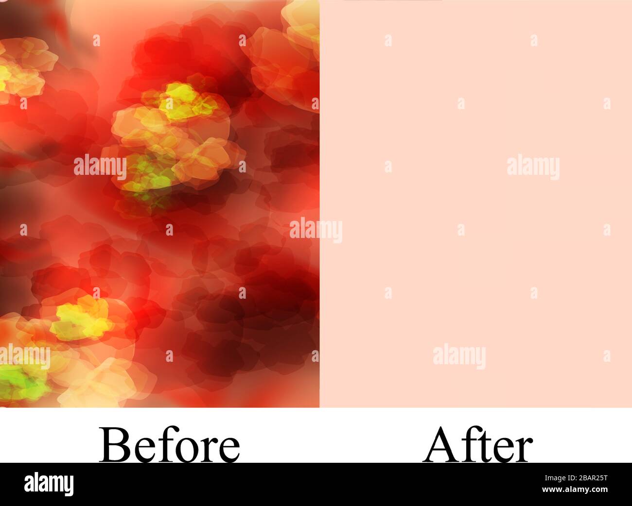 Texture, inflamed pimples and acne. Before After acne cysts. Skin ...