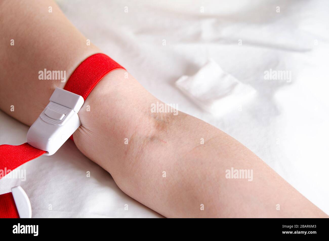 Woman's vein ready for intravenous injection during Stock Photo - Alamy