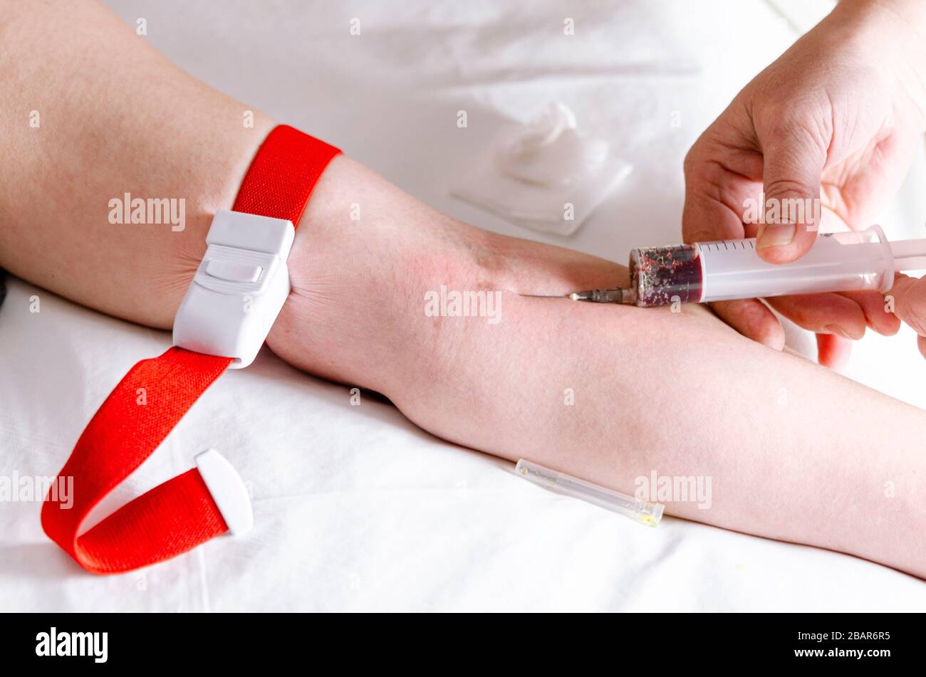 A woman's hand when hooked to intravenous infection and blood test ...