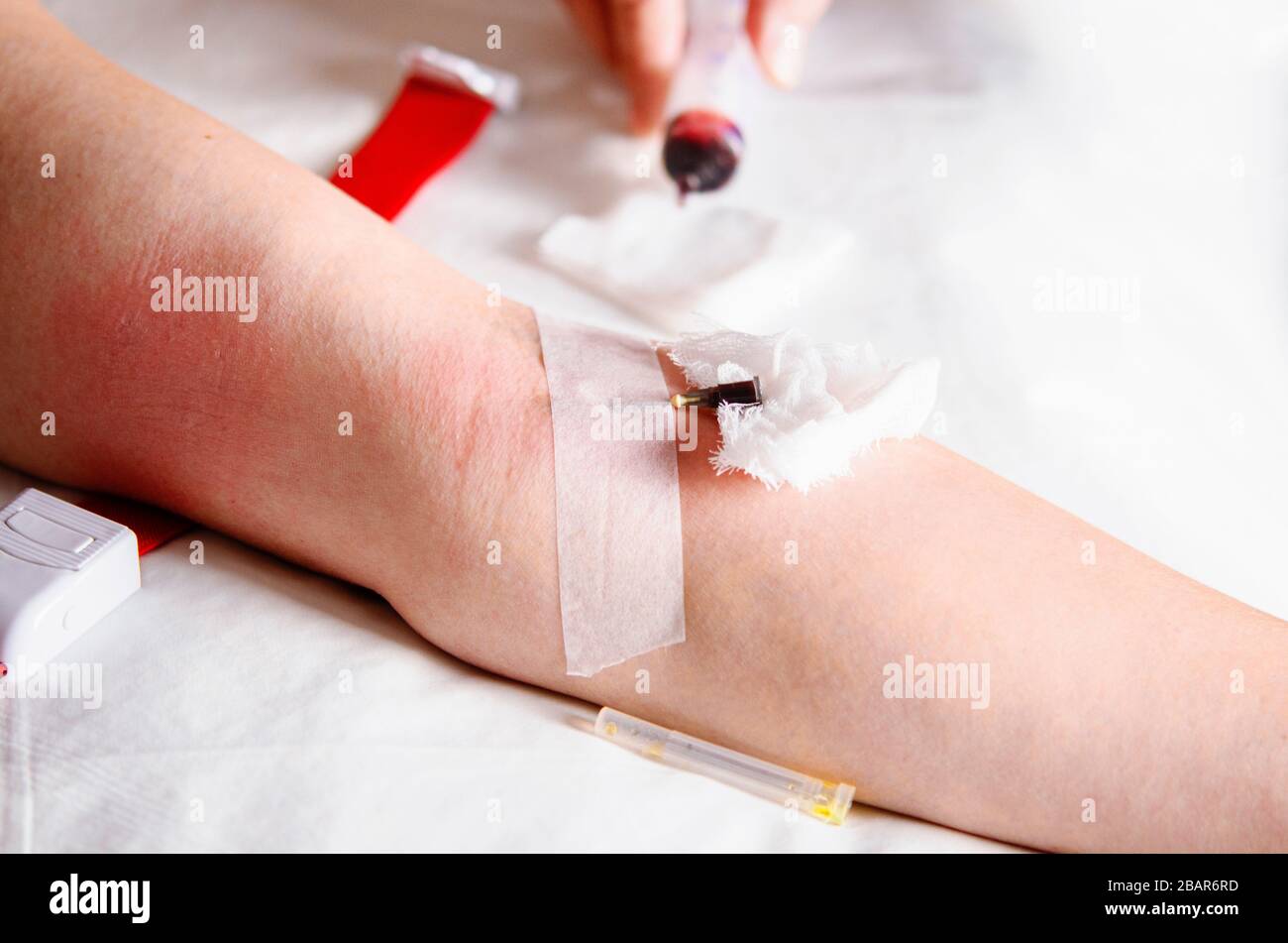 A woman's hand when hooked to intravenous infection and blood test ...