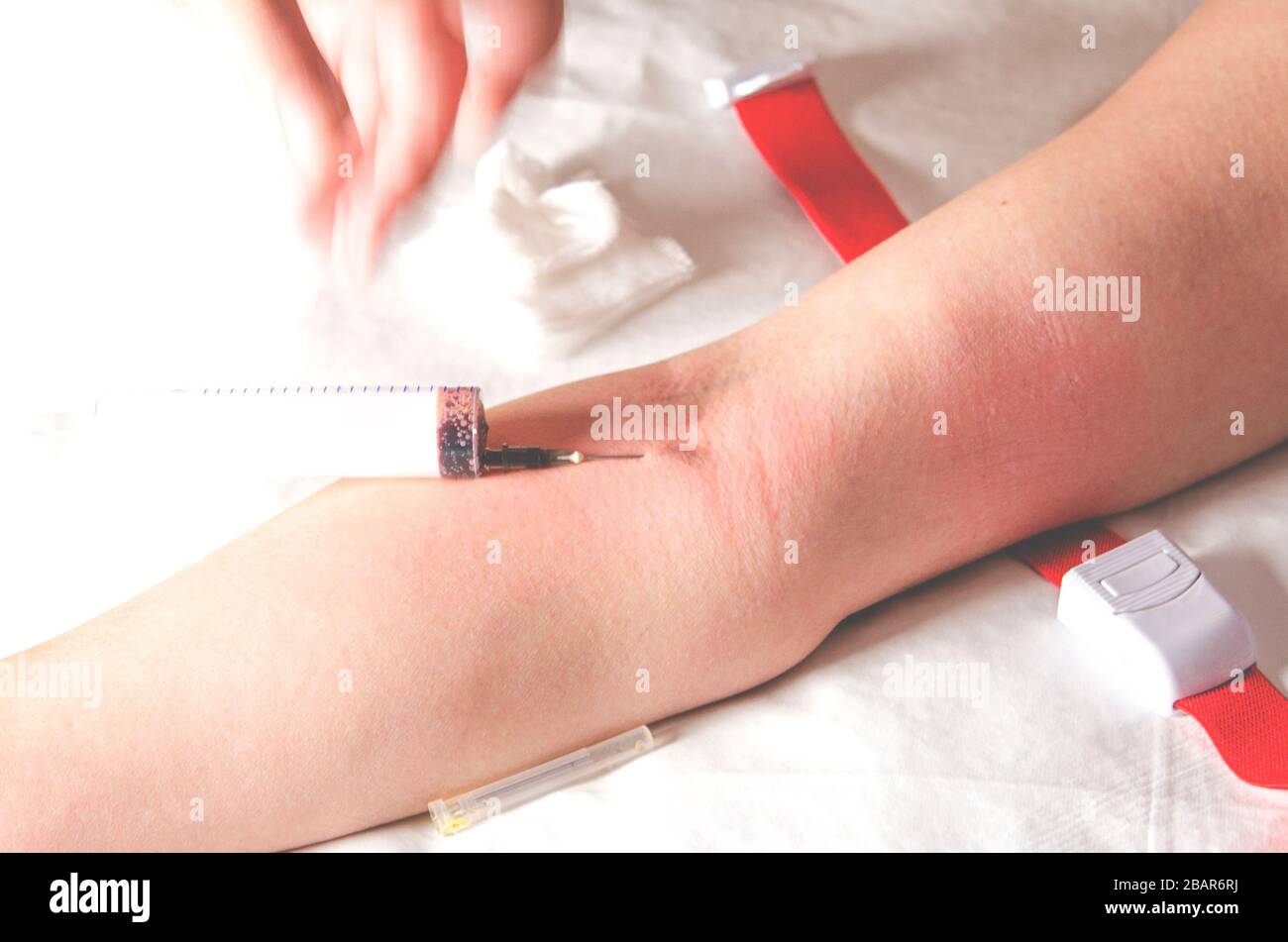 A woman's hand when hooked to intravenous infection and blood test ...