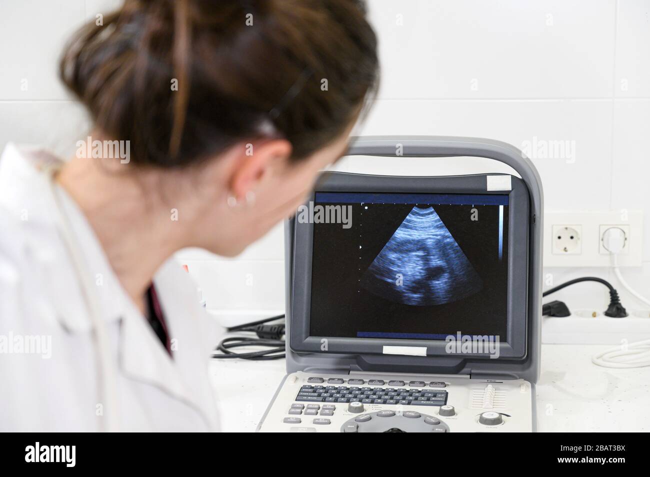 Doctor watching Ultrasound or Sonogram screen in the Hospital Stock ...