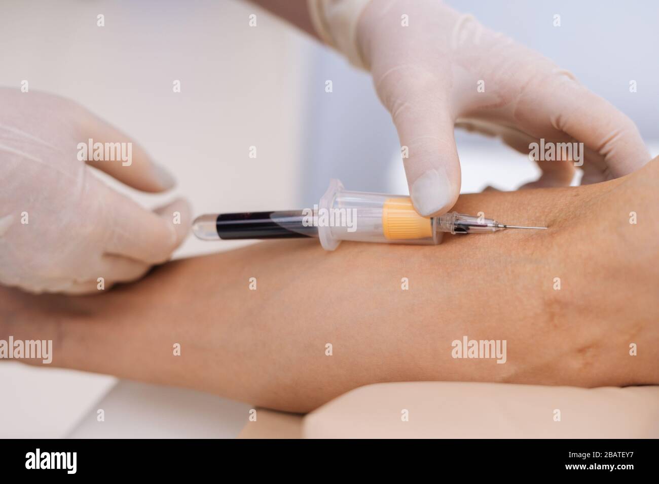 Laboratory assistant collecting blood sample from veins with vacuum ...