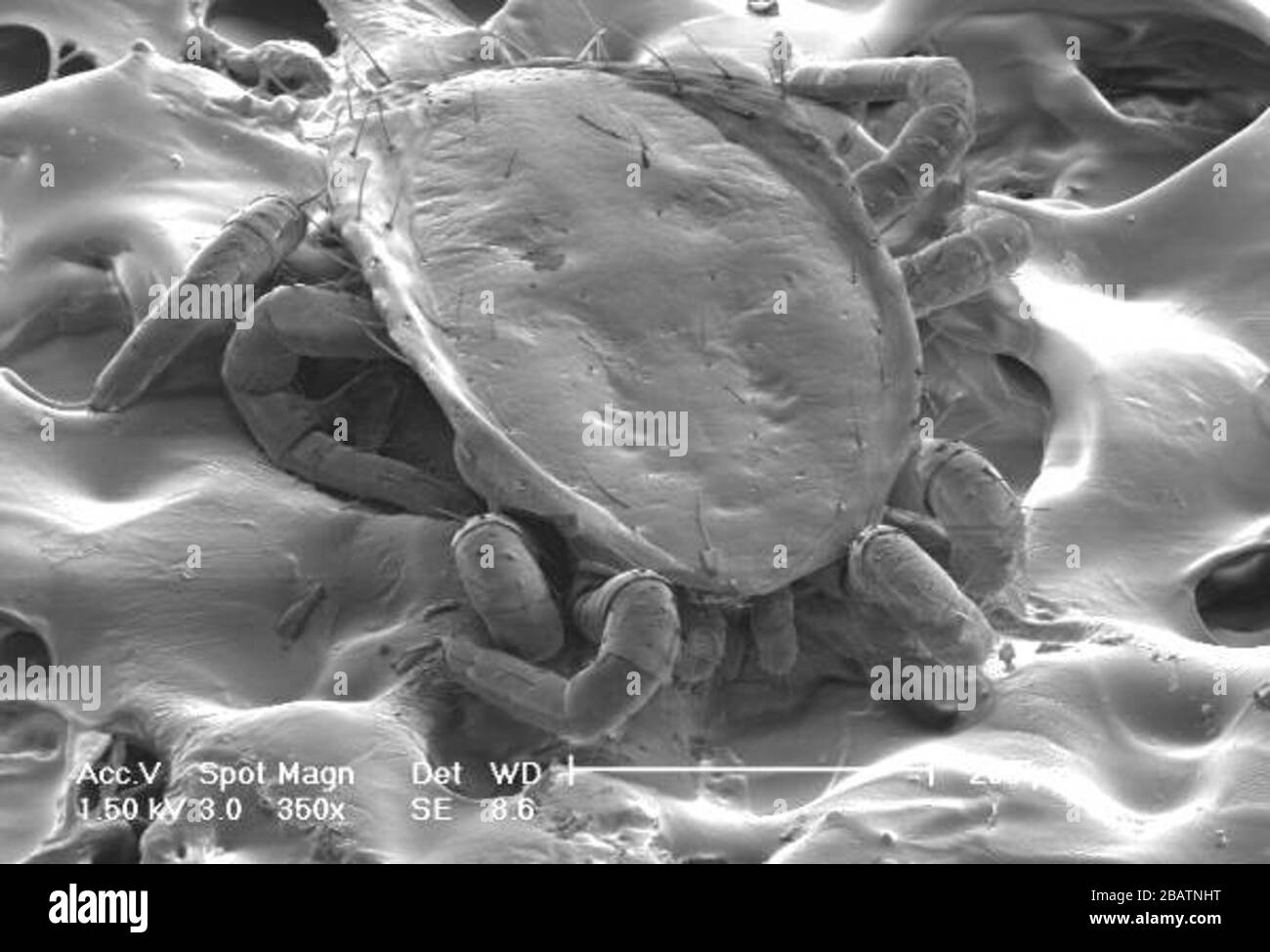 Acari microscope hi-res stock photography and images - Alamy