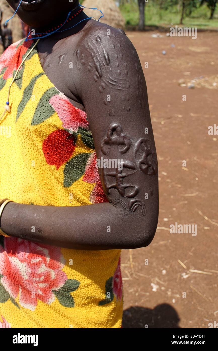 Mursi Tribe Scarification