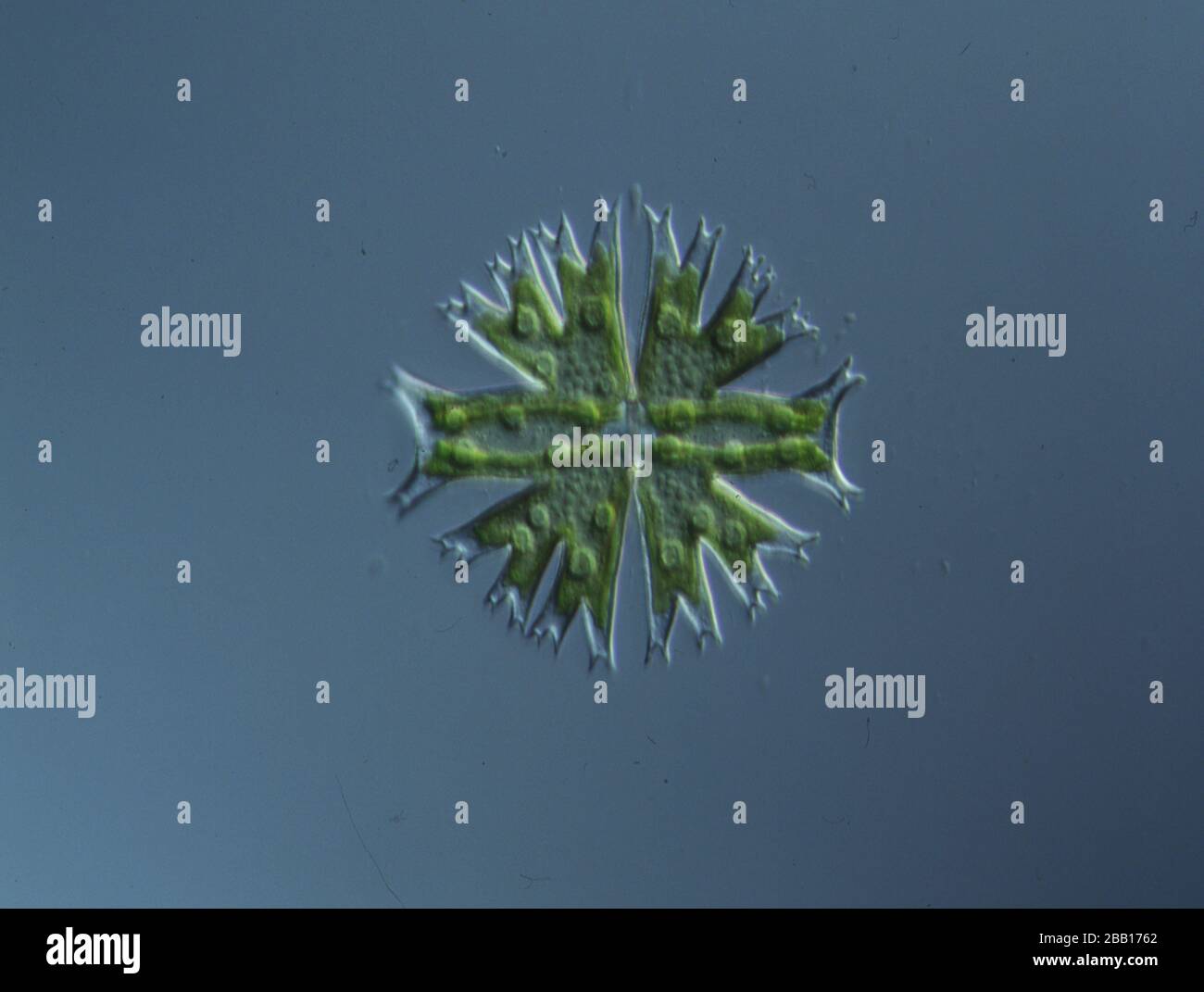 Ornamental algae Micrasterias in drops of water 100x Stock Photo - Alamy