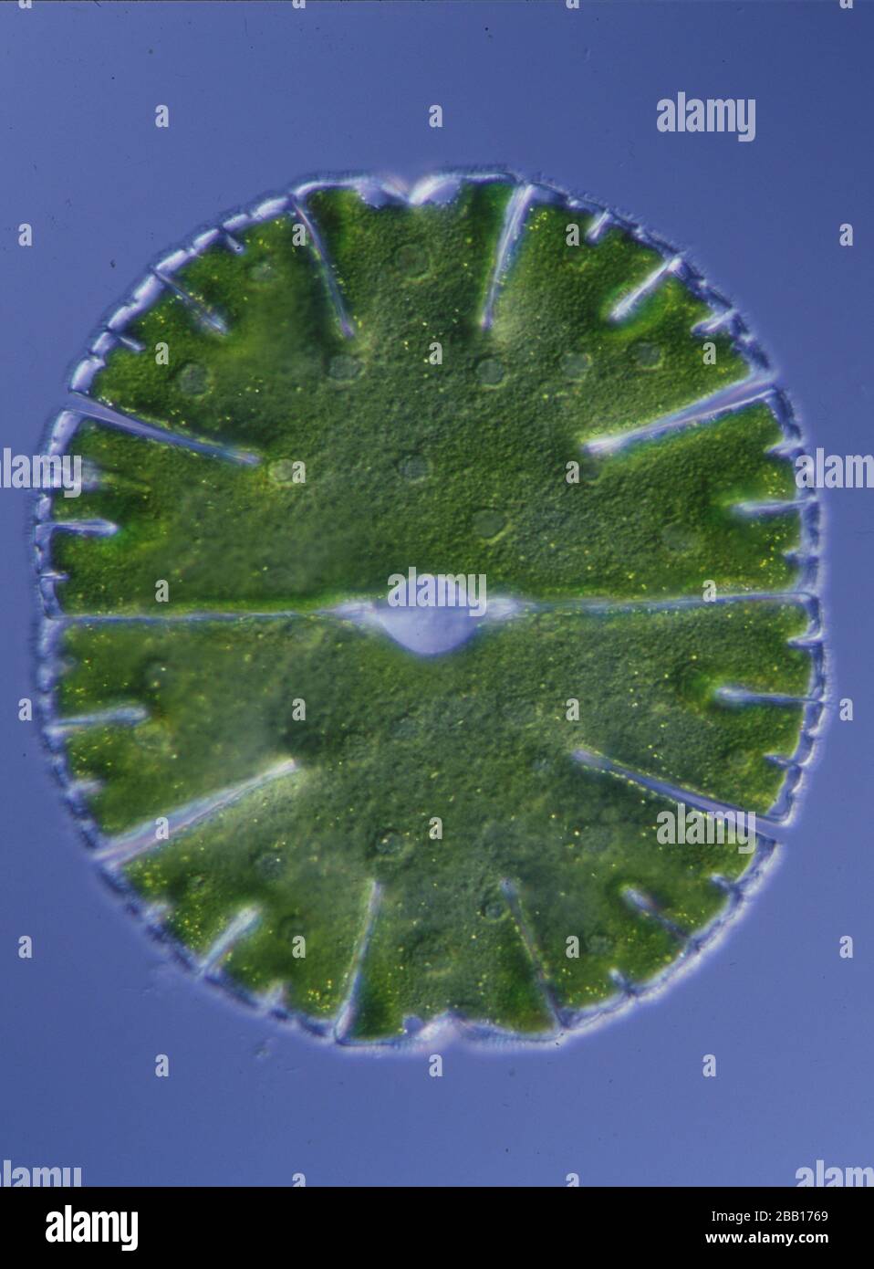 Ornamental algae Micrasterias in drops of water 100x Stock Photo - Alamy