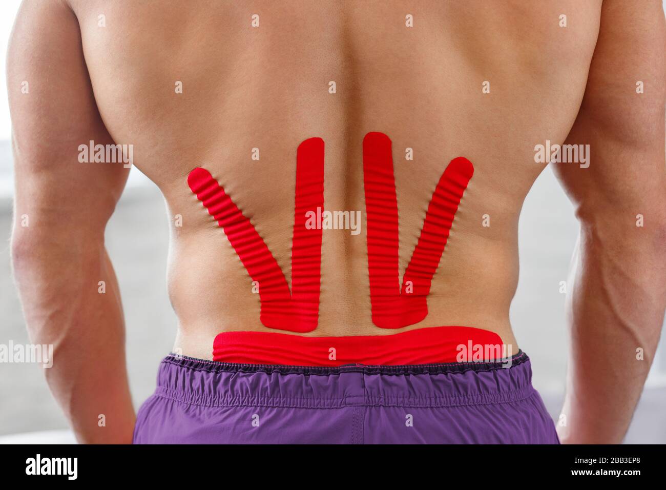 Kinesiology taping. Physical therapist applying kinesiology tape Stock Photo - Alamy