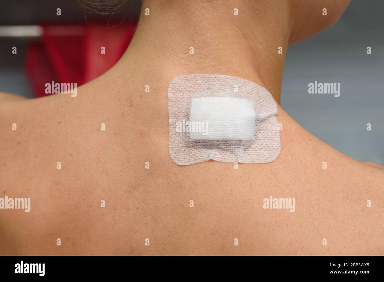 Medical Patch pasted on the wound on the girl's neck Stock Photo - Alamy
