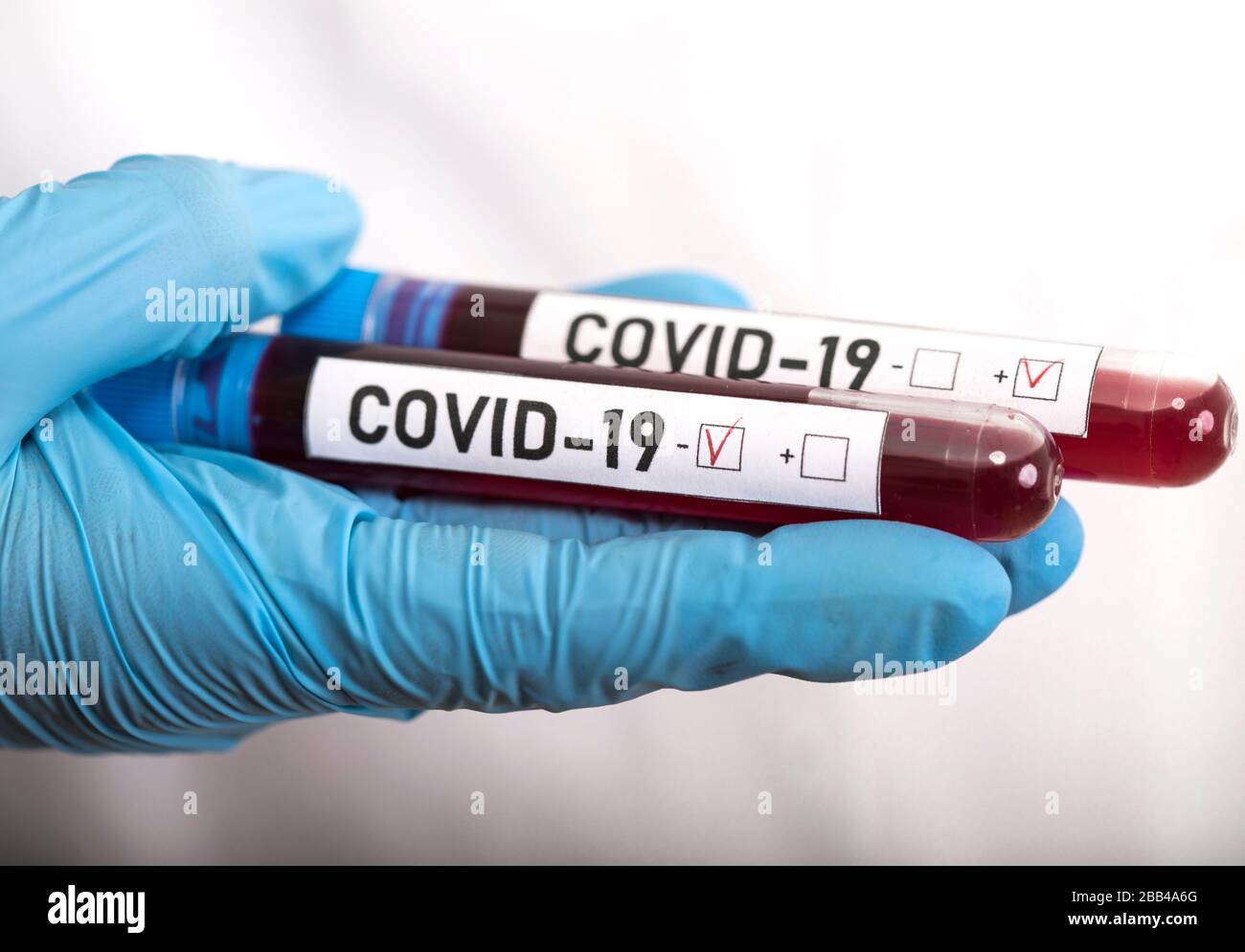 Microbiologist with a tube of biological sample contaminated by ...