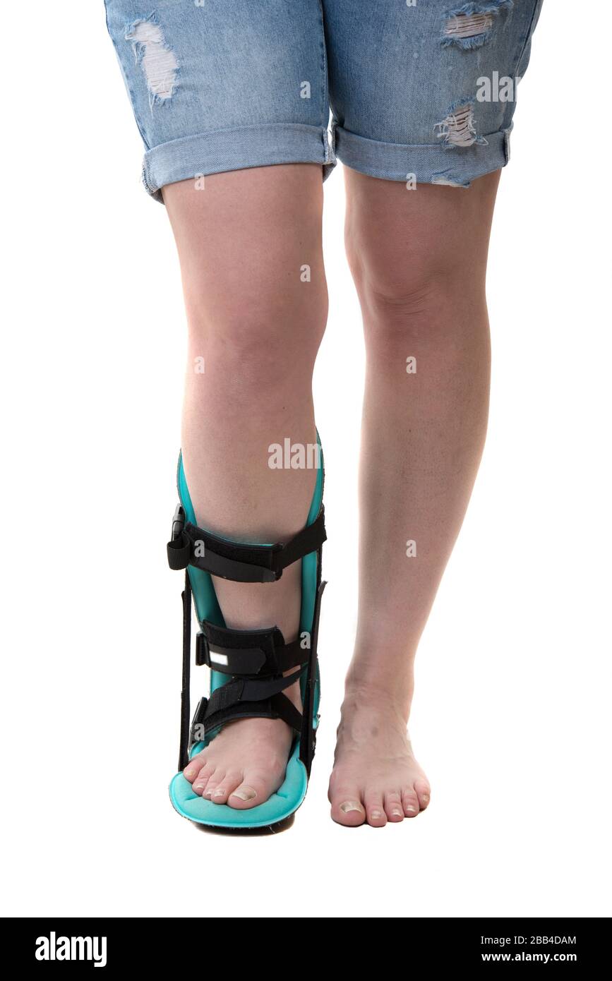 Cloe up of woman legs with night splint foot orthosis Stock Photo - Alamy