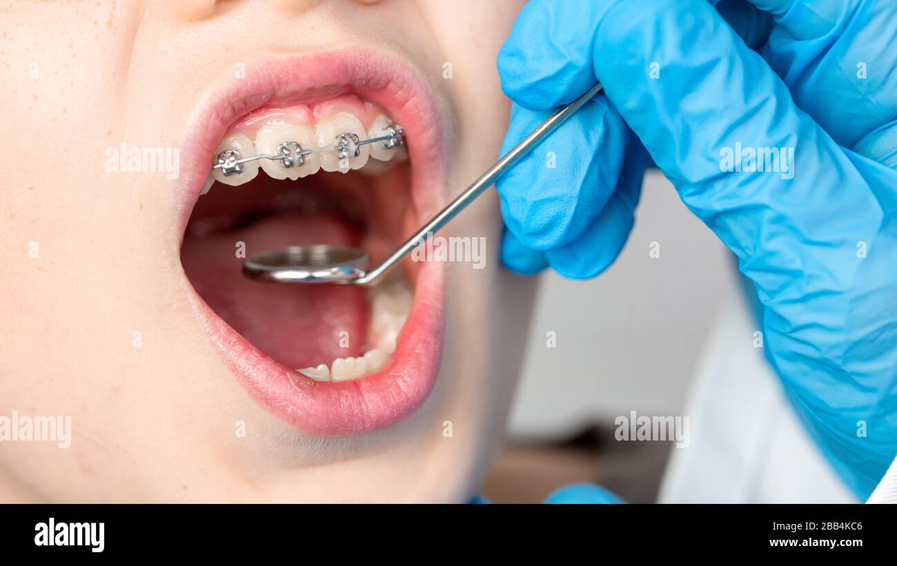 Closeup of dentist using an instrument to visualize the teeth of a ...