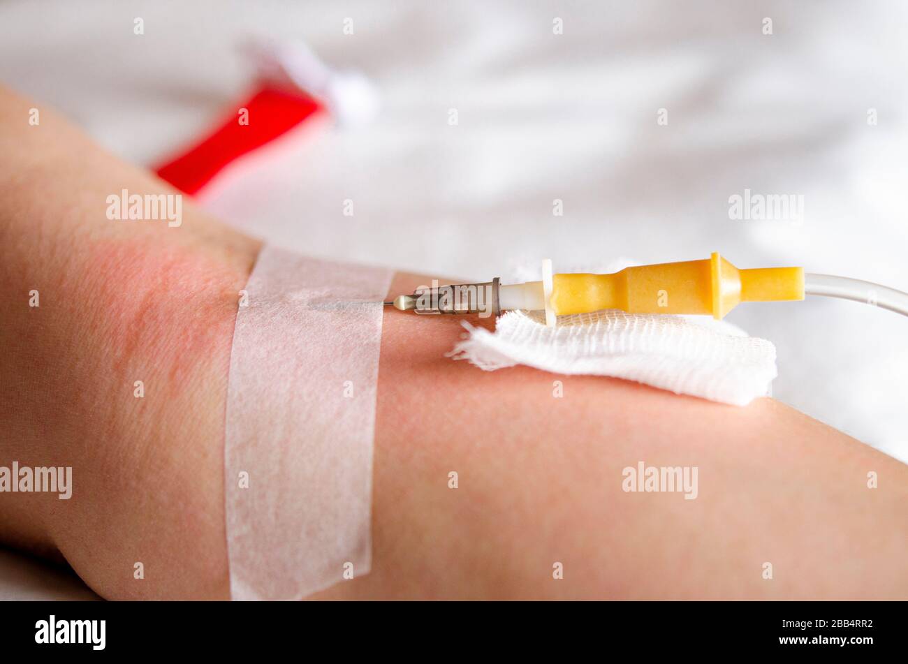 The needle of the drip stands in the vein for the introduction of ...