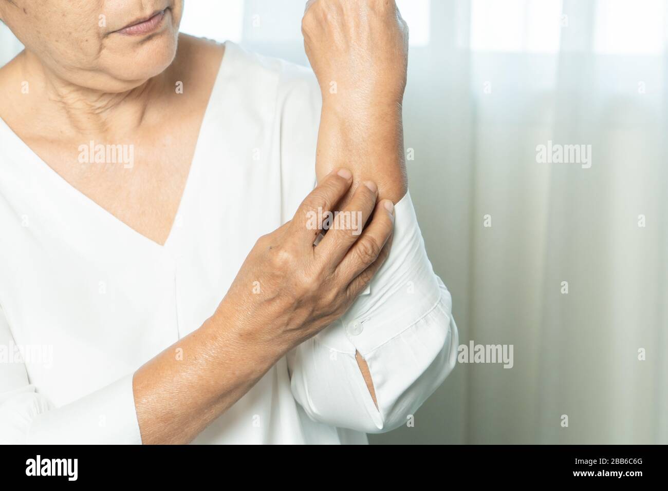 senior women scratch hand the itch on eczema arm, healthcare and ...