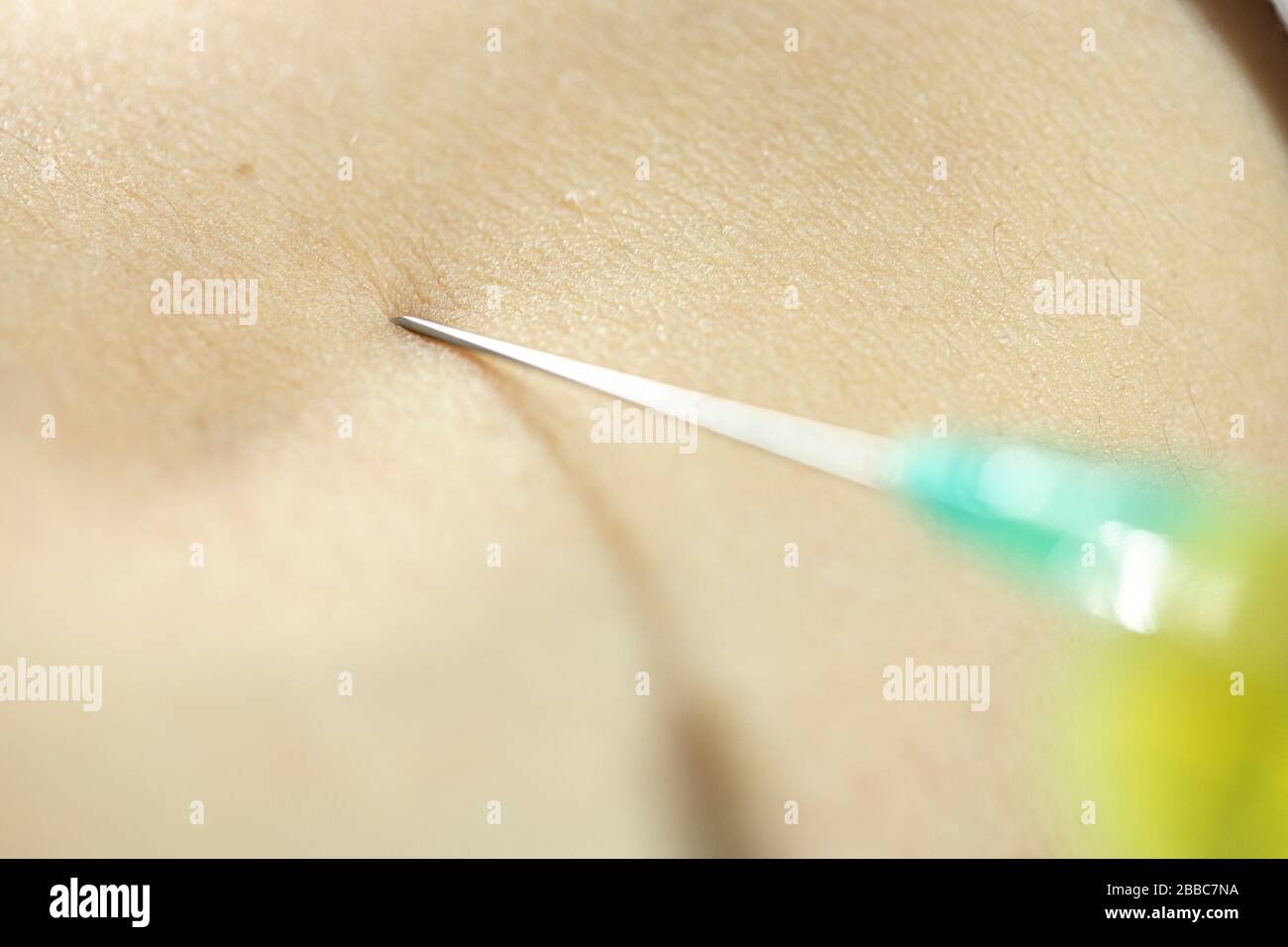 Syringe with yellow liquid inside. While being injected into the human ...