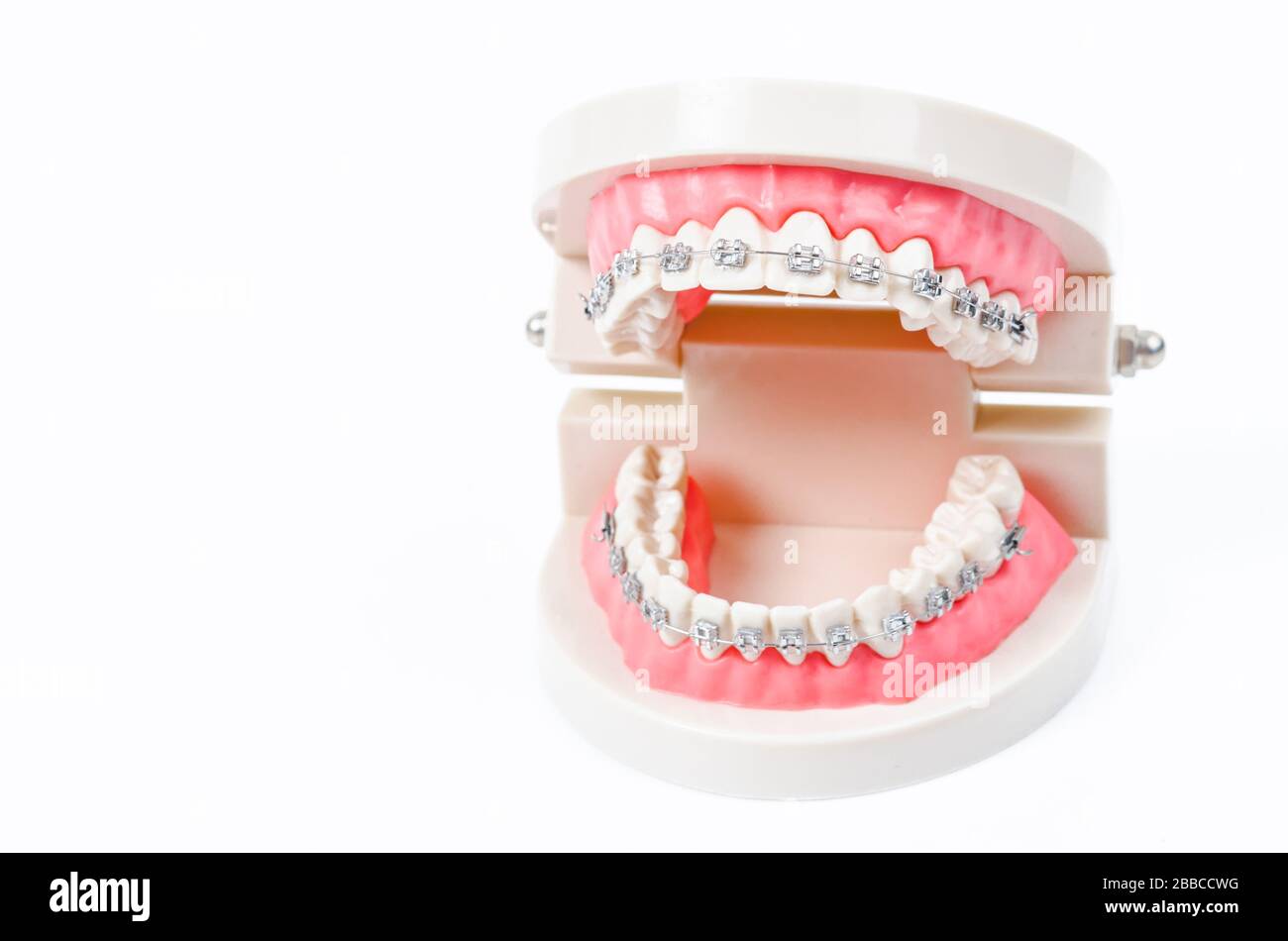 tooth model with metal wire dental braces isolated on white background ...