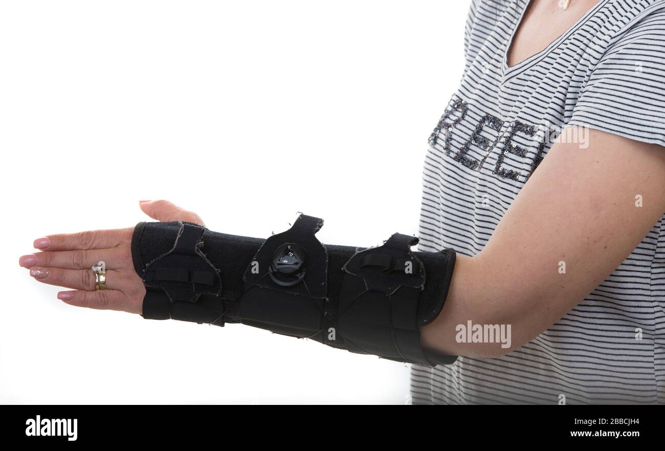 Woman with left hand orthosis isolated onw hite background Stock Photo ...