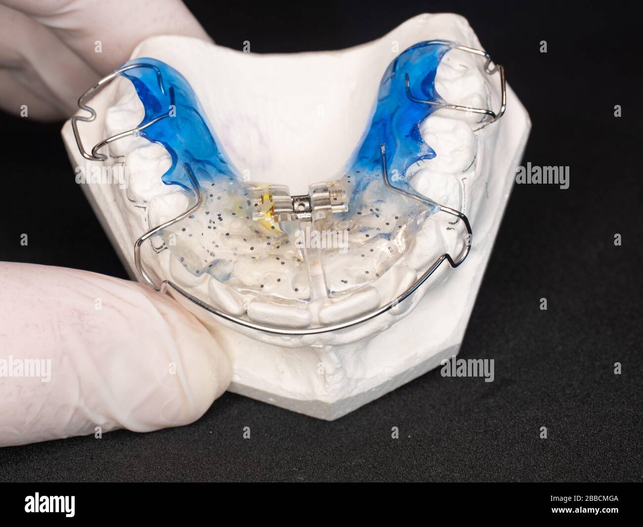 Dental Blue Removable Brace or Retainer for Teeth Orthodontic in medic ...