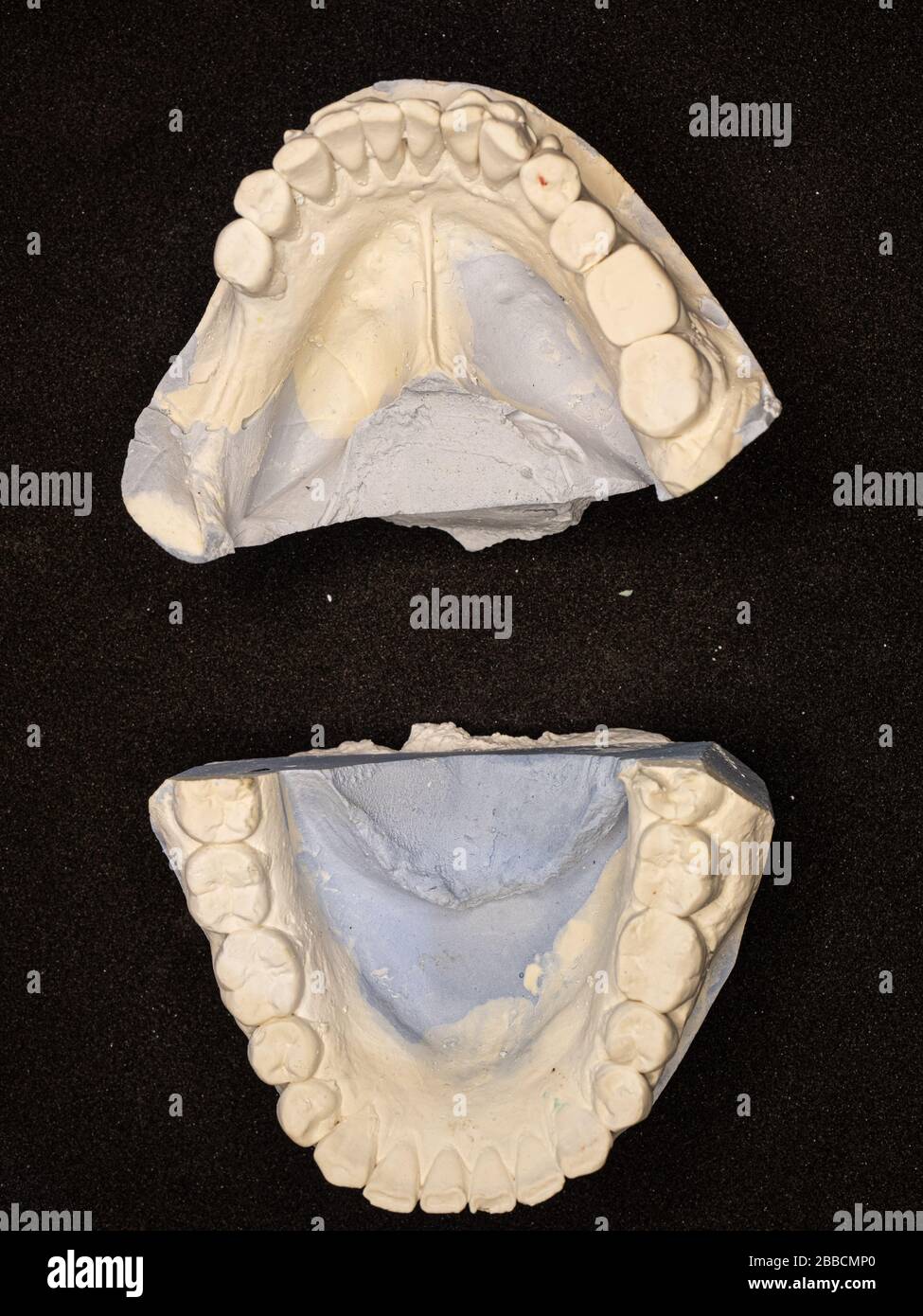 Dental gypsum model mould teeth hi-res stock photography and images - Alamy