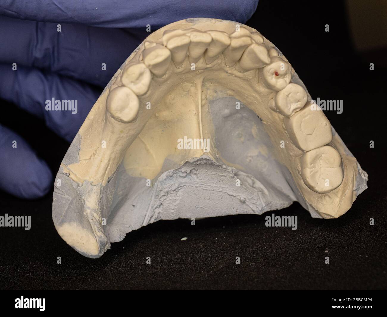Dental gypsum model mould teeth hi-res stock photography and images - Alamy