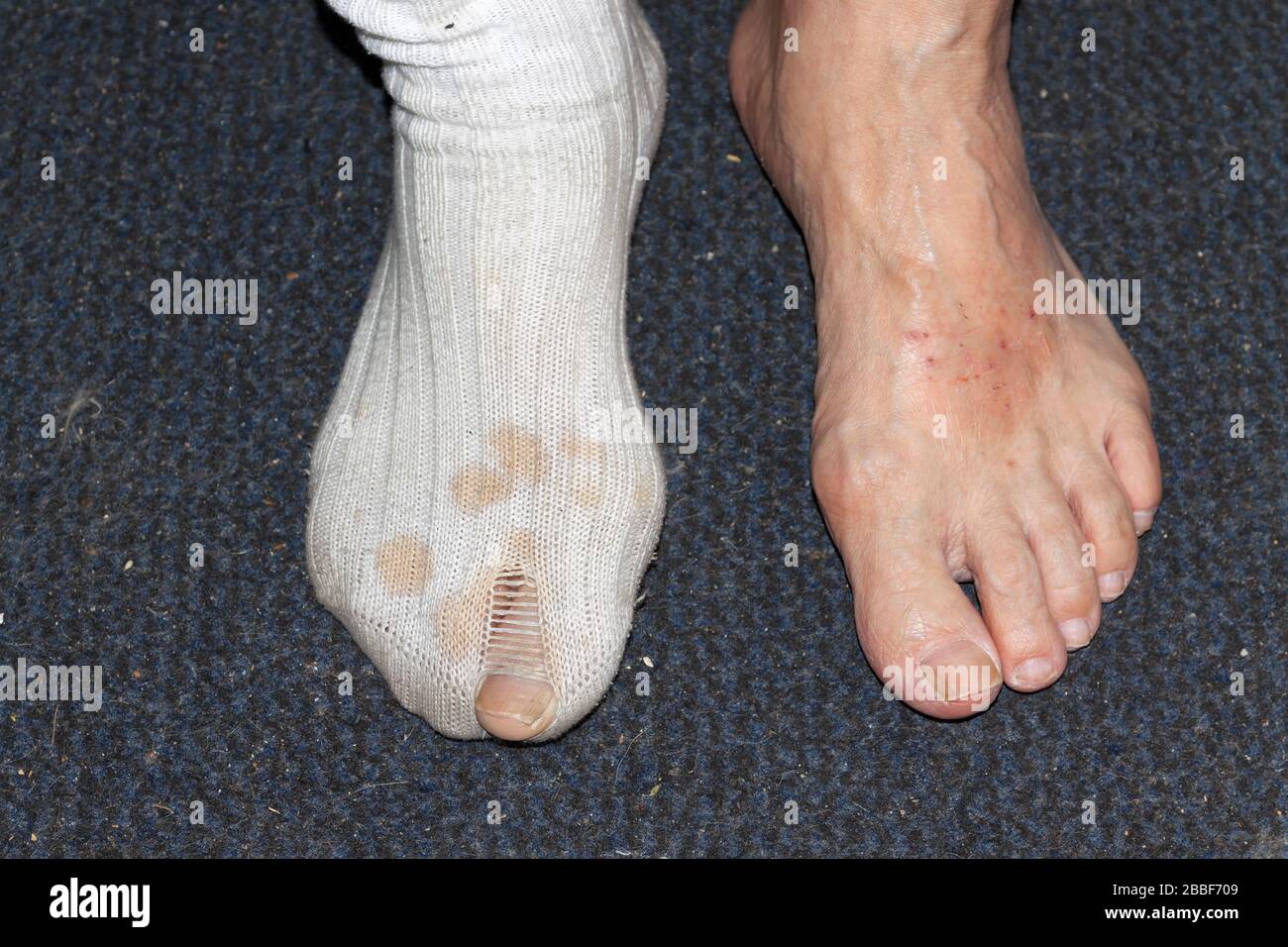 Symbolic photo for neglect Stock Photo - Alamy